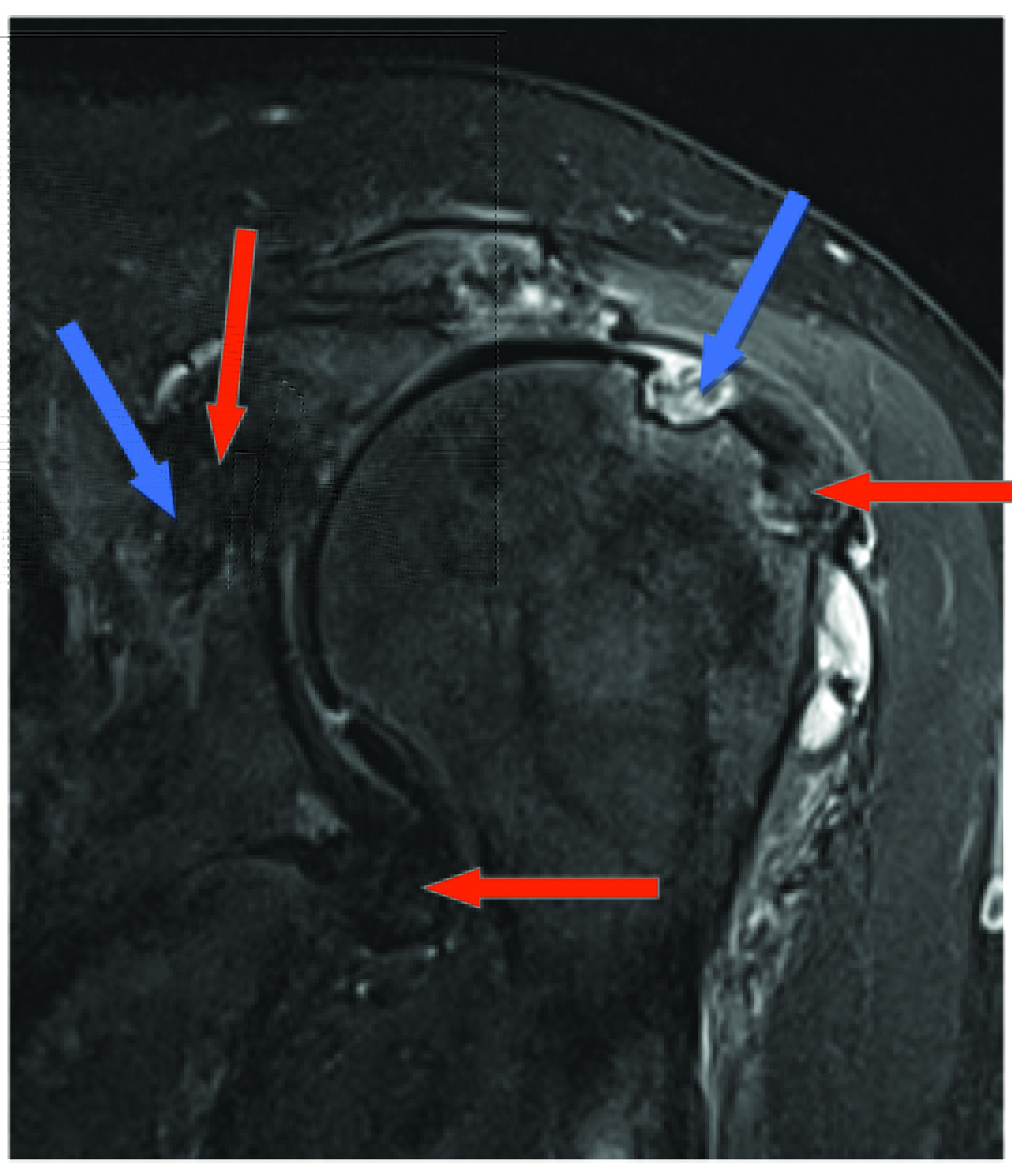 Case study: Unexplained shoulder pain - Medical Republic
